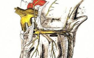 Suprazygomatic Sphenopalatine Ganglion Block May Quickly Relieve Status ...