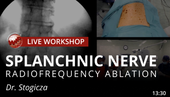 Stogicza - Splanchnic Nerve Radiofrequency Ablation - PainCast